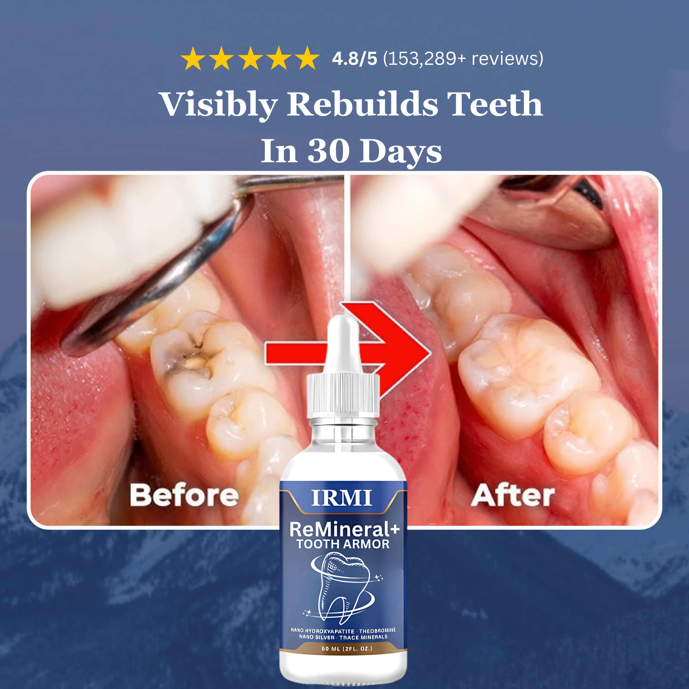 Advanced Tooth Armor Dentite – Irmi
